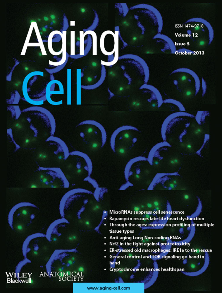 acel.2013.12.issue-5.cover - PiperLab
